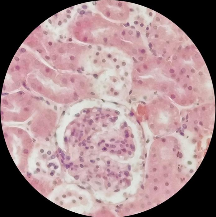 Solved digitally label the glomerulus and bowmans capsule | Chegg.com