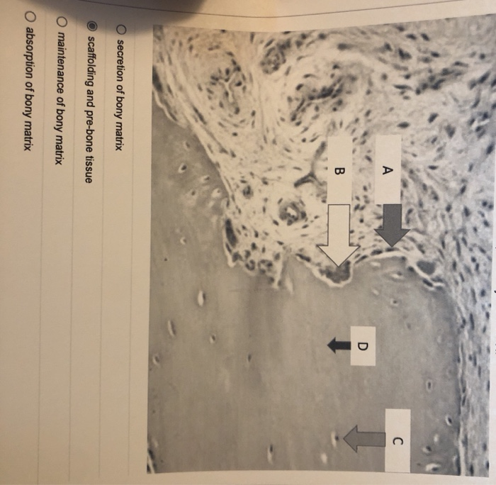 Solved с A 1 D B с A D B secretion of bony matrix | Chegg.com