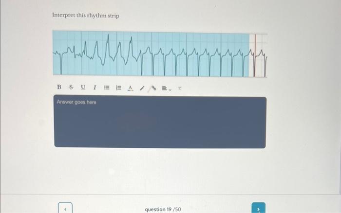 Solved Interpret this rhythm strip Interpret this rhythm | Chegg.com