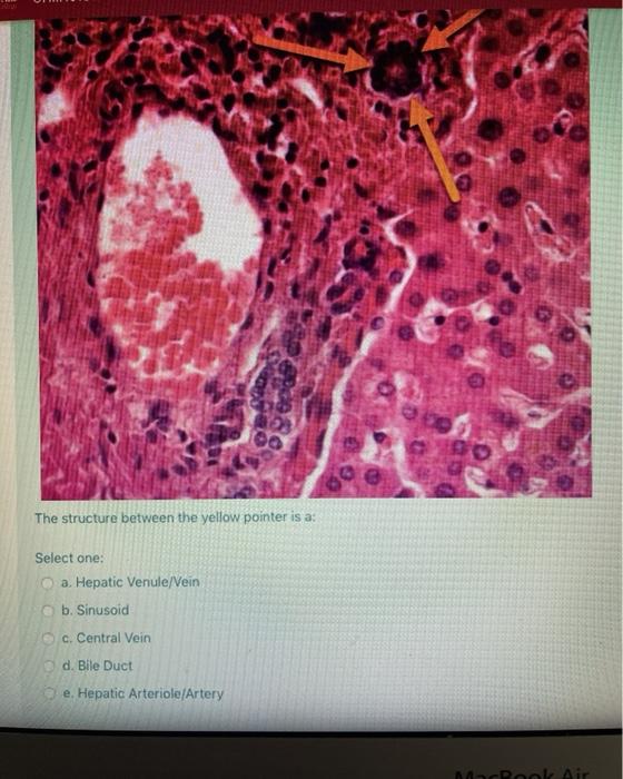 Solved The structure between the yellow pointer is a: Select | Chegg.com