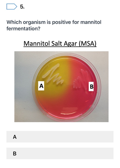 Solved 4. Which organism(s) are beta-hemolytic on this blood | Chegg.com
