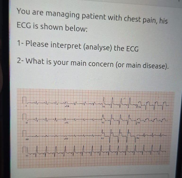 Solved You are managing patient with chest pain, his ECG is | Chegg.com