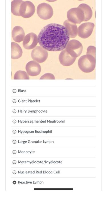 Solved od NO Blast Giant Platelet Hairy Lymphocyte | Chegg.com