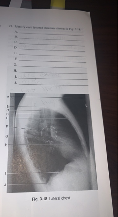 Solved E H 8. Identify each lettered structure shown in Fig. | Chegg.com
