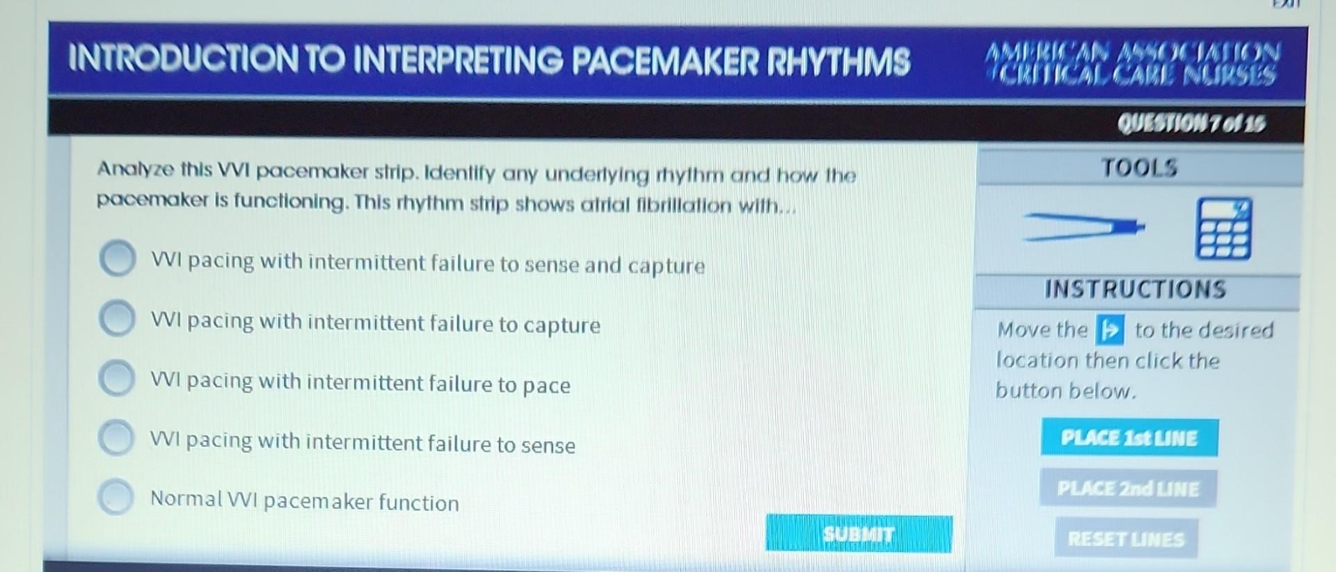 Anolyze this VVI pacemaker strip. Identify any | Chegg.com