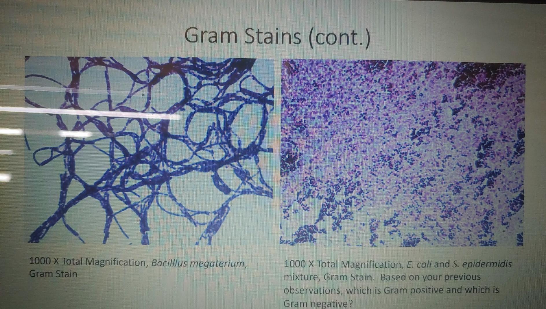 Staphylococcus Epidermidis Negative Stain