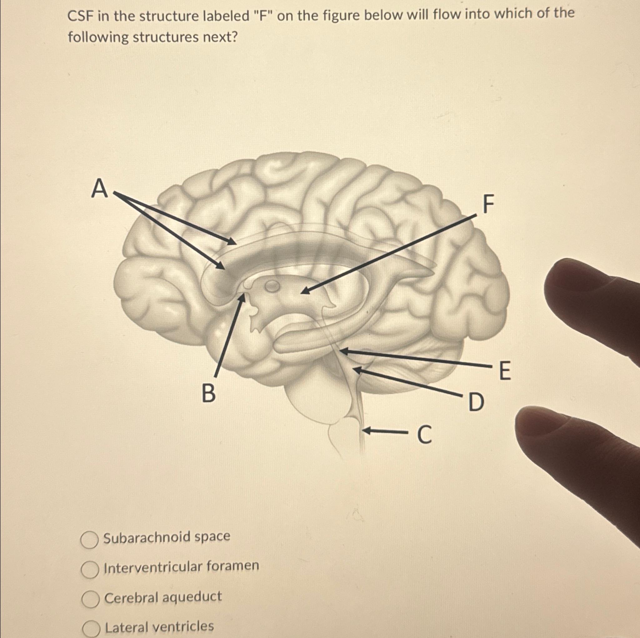 Solved CSF in the structure labeled " F " ﻿on the figure | Chegg.com