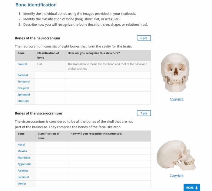 Solved Bone identification 1. Identify the individual bones | Chegg.com