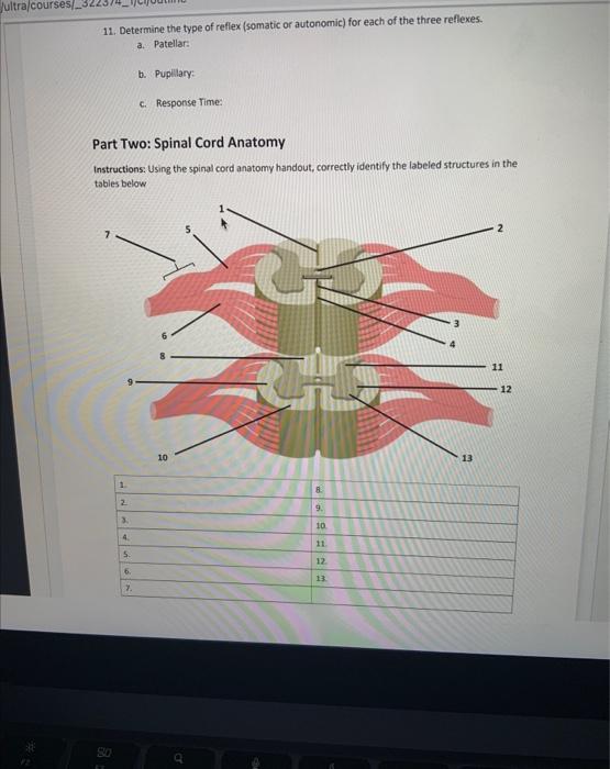 Solved Using the spinal cord anatorny handout and reflex | Chegg.com