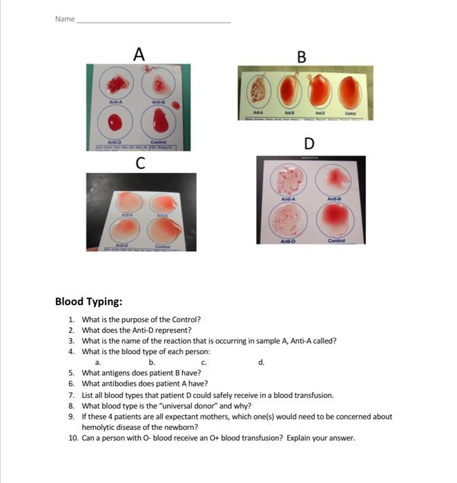 Solved Blood Typing: 1. What is the purpose of the Control? | Chegg.com