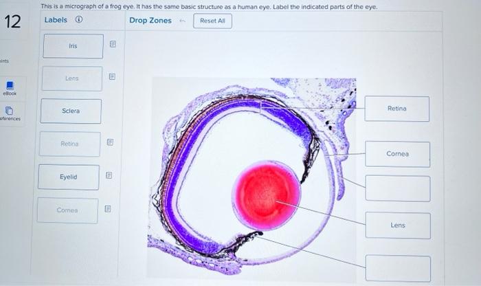 Solved This is a micrograph of a frog eye. it has the same | Chegg.com