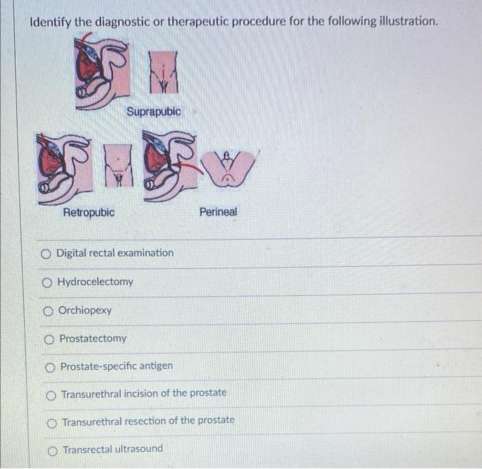 Solved Identify the diagnostic or therapeutic procedure for | Chegg.com