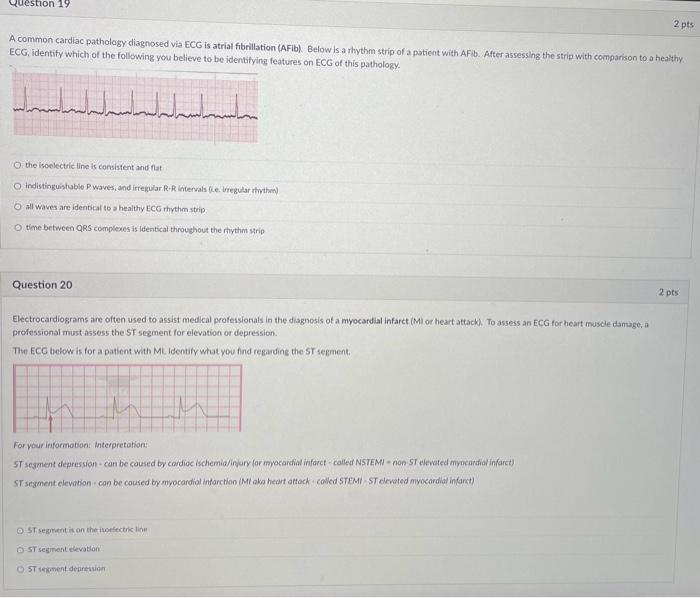 Solved A common cardiac pathology diagnosed via ECG is | Chegg.com