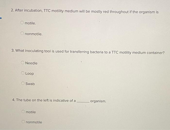 Solved 2. After incubation, TTC motility medium will be | Chegg.com