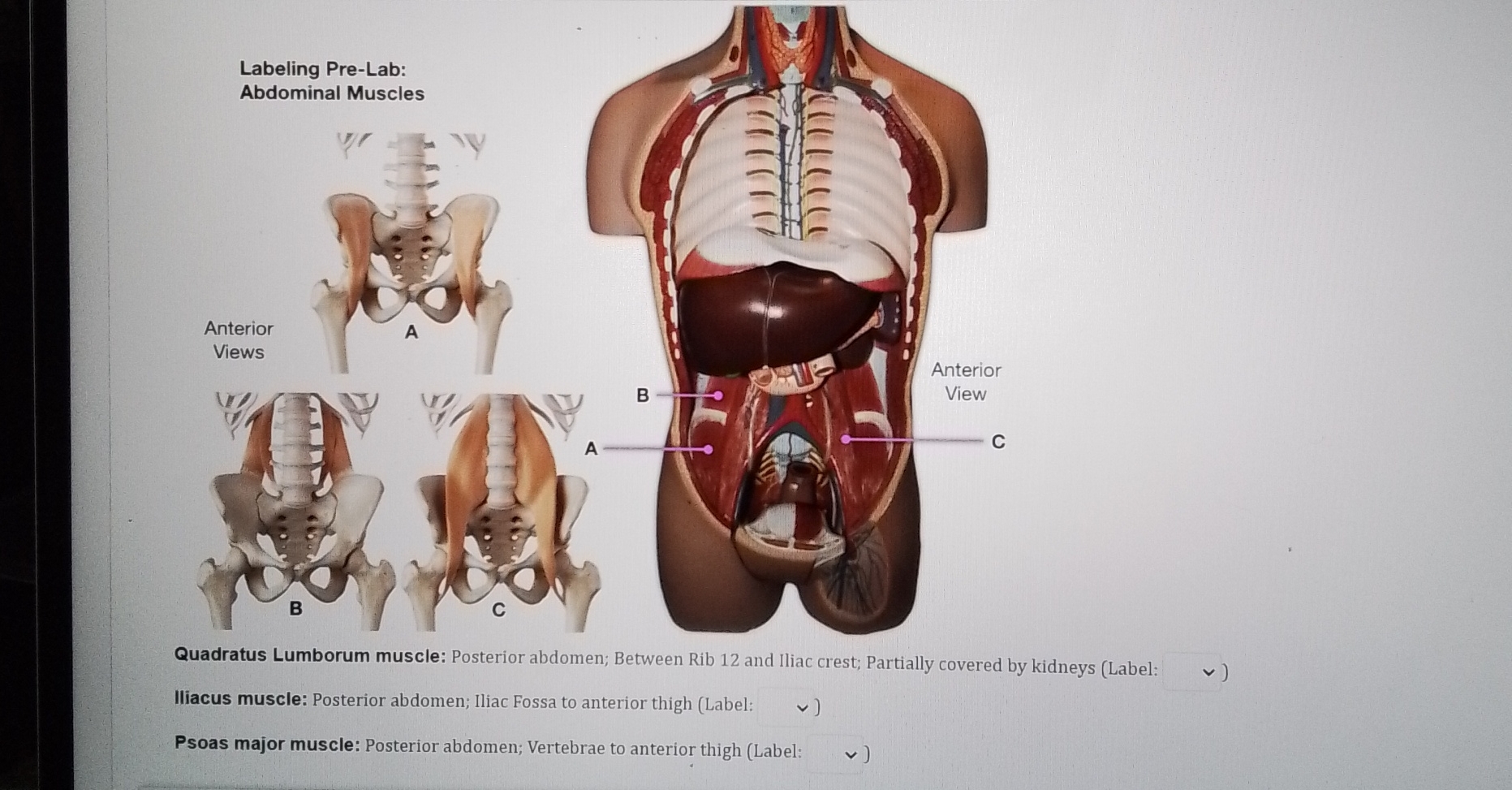 Solved Iliacus muscle: Posterior abdomen; Iliac Fossa to | Chegg.com