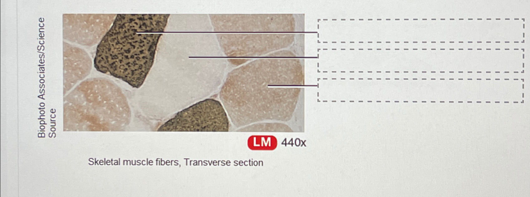 Solved Skeletal muscle fibers, Transverse section | Chegg.com