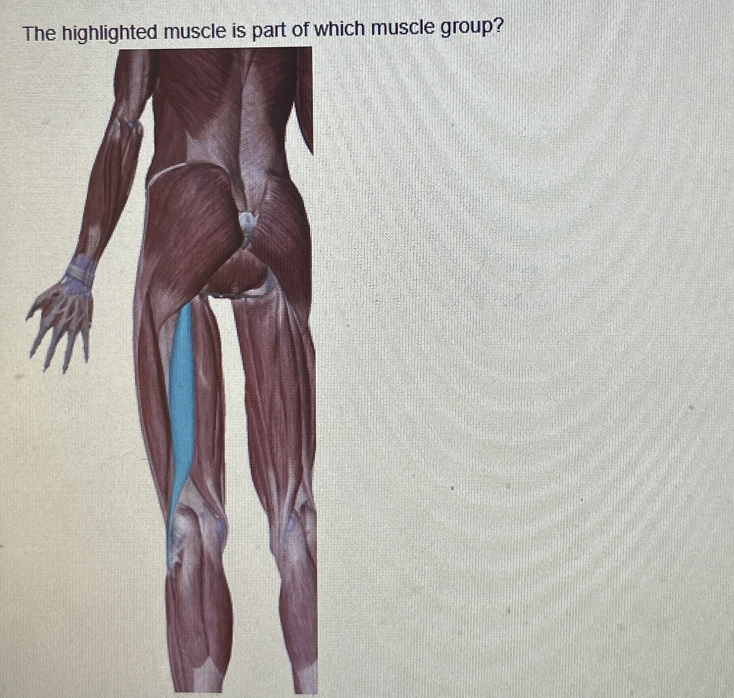 Solved The highlighted muscle is part of which muscle | Chegg.com