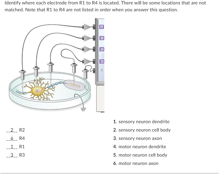 Solved Identify where each electrode from R1 ﻿to R4 ﻿is | Chegg.com