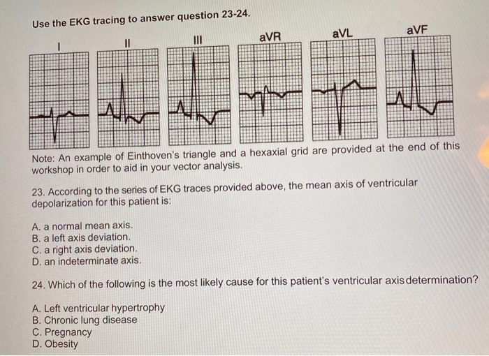 Solved Use the EKG tracing to answer question 23-24. aVR aVL | Chegg.com