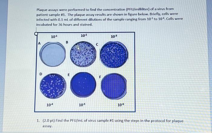 Solved Plaque assays were performed to find the | Chegg.com