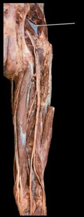 Solved identify the highlighted muscle. I've already tried | Chegg.com