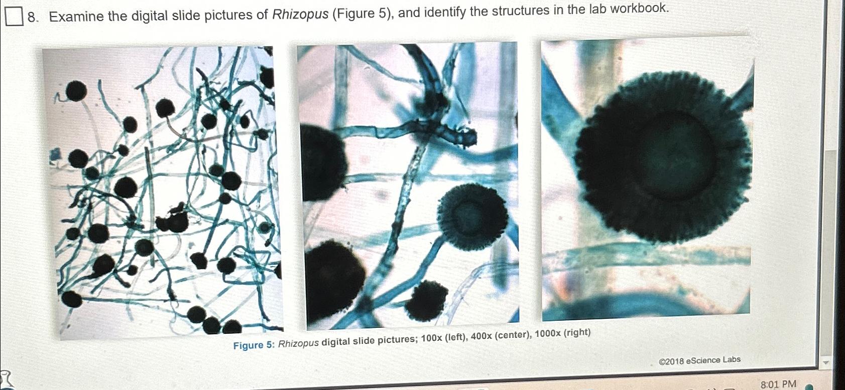Solved Examine the digital slide pictures of Rhizopus | Chegg.com