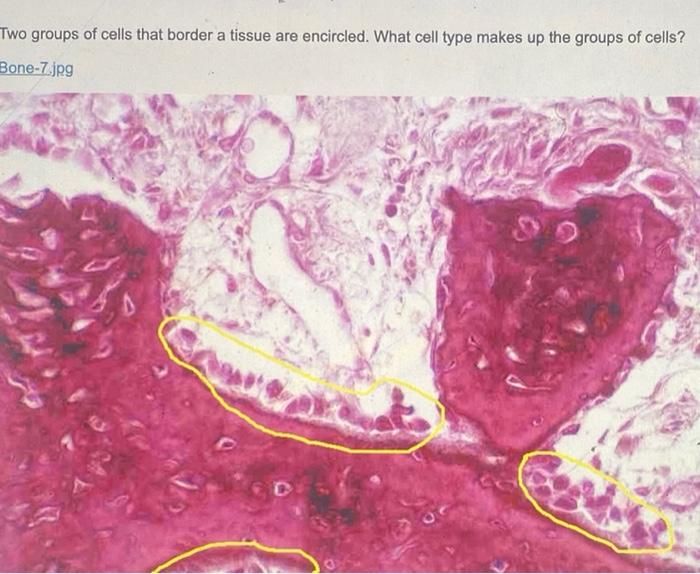 Solved Two groups of cells that border a tissue are | Chegg.com