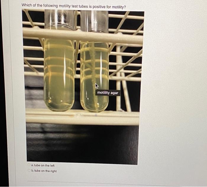 Solved Which of the following motility test tubes is | Chegg.com