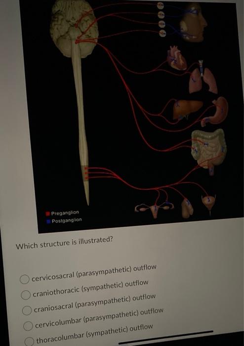 Solved Which structure is highlighted? longitudinal fissure | Chegg.com
