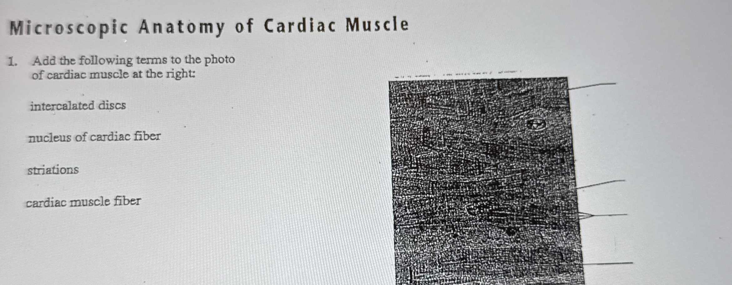 Solved Microscopic Anatomy of Cardiac MuscleAdd the | Chegg.com