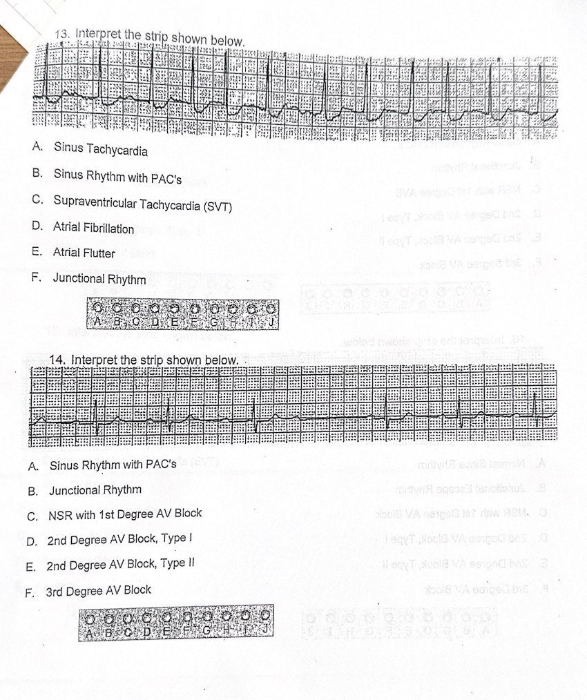 Solved 13. ﻿Interpret the strip shown below. A. ﻿Sinus | Chegg.com