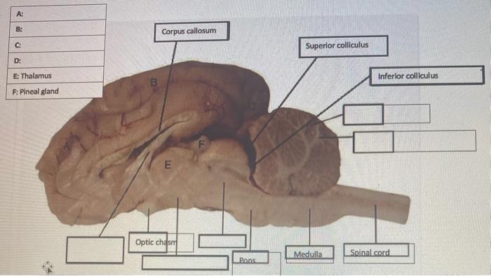 Solved A: B: Corpus callosum c Superior colliculus D: | Chegg.com
