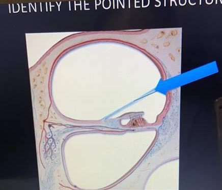 Solved IDENTIFY THE POINI | Chegg.com