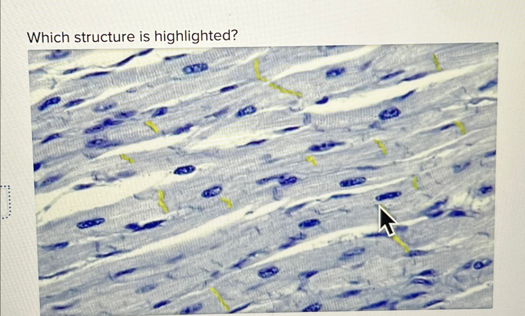 Solved Which structure is highlighted? | Chegg.com