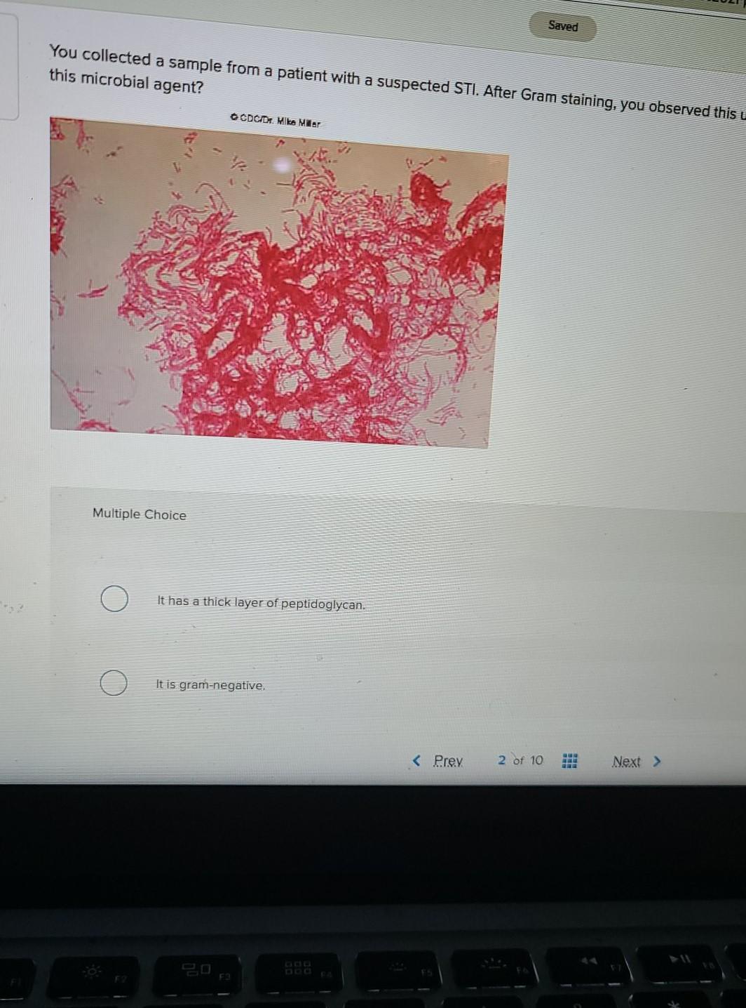 Saved You collected a sample from a patient with a | Chegg.com