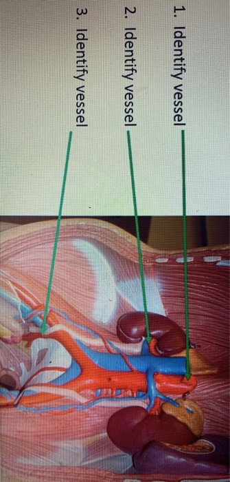 Solved 1. Identify vessel 2. Identify vessel 3. Identify | Chegg.com