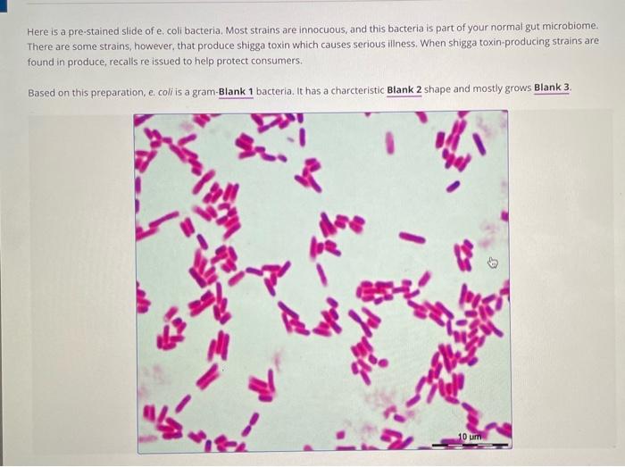 Solved Here is a pre-stained slide of e. coli bacteria. Most | Chegg.com
