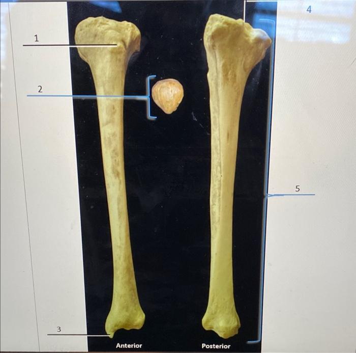 Solved label | Chegg.com