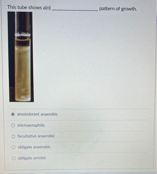 Solved This tube shows a(n) pattern of growth. areotolerant | Chegg.com