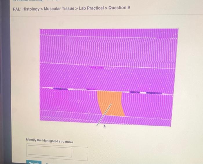 Solved PAL: Histology > Epithelial Tissue > Lab Practical > | Chegg.com