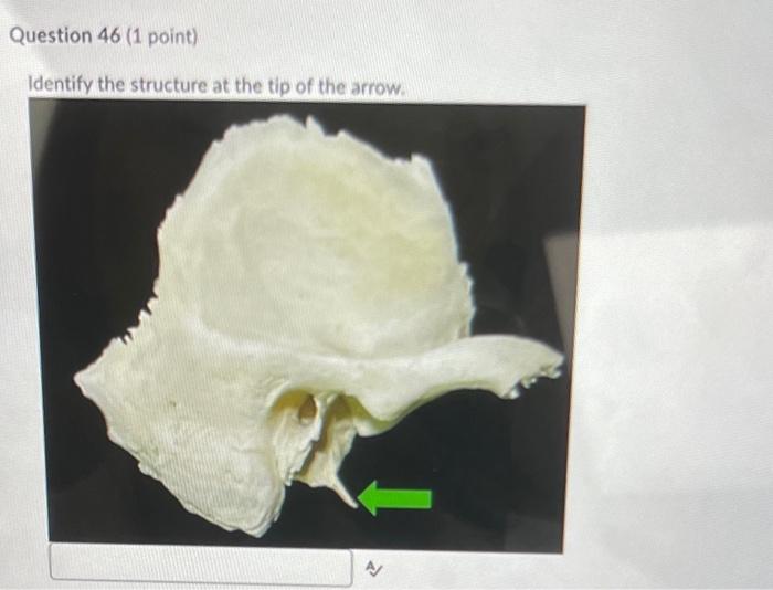 Solved Identify the structure at the tip of the arrow. | Chegg.com