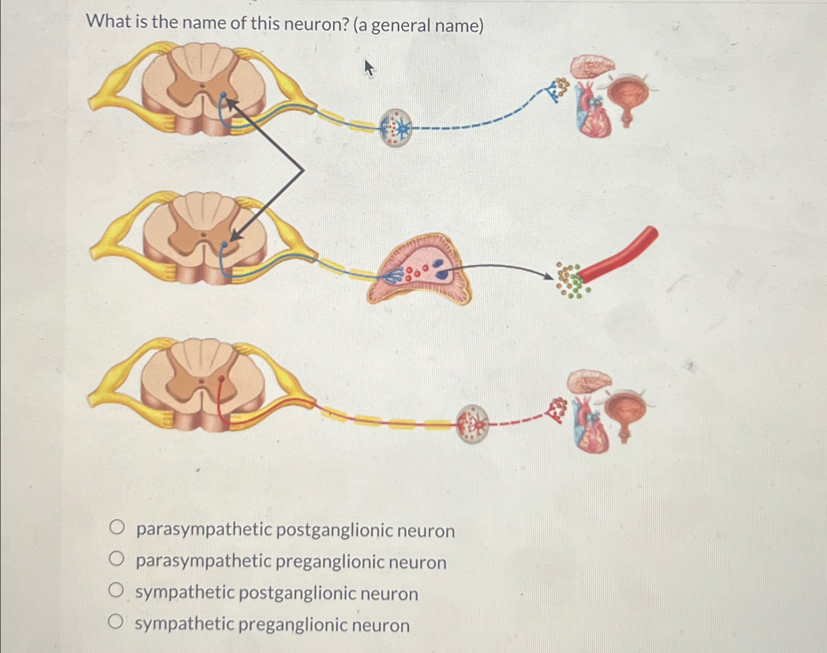 Solved What is the name of this neuron? (a general | Chegg.com