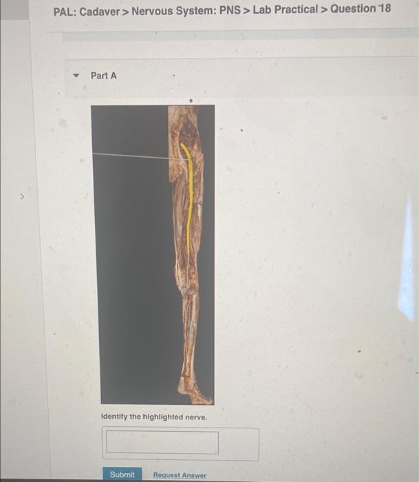 Solved Pal Cadaver Nervous System Pns Lab Practical