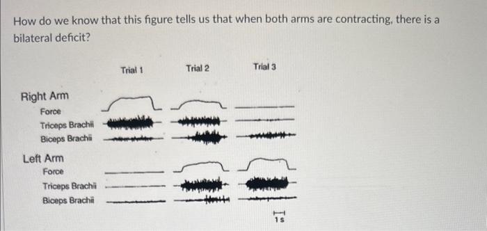 How do we know that this figure tells us that when | Chegg.com