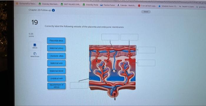 Solved Correctly label the folowing vessels of the placenta | Chegg.com