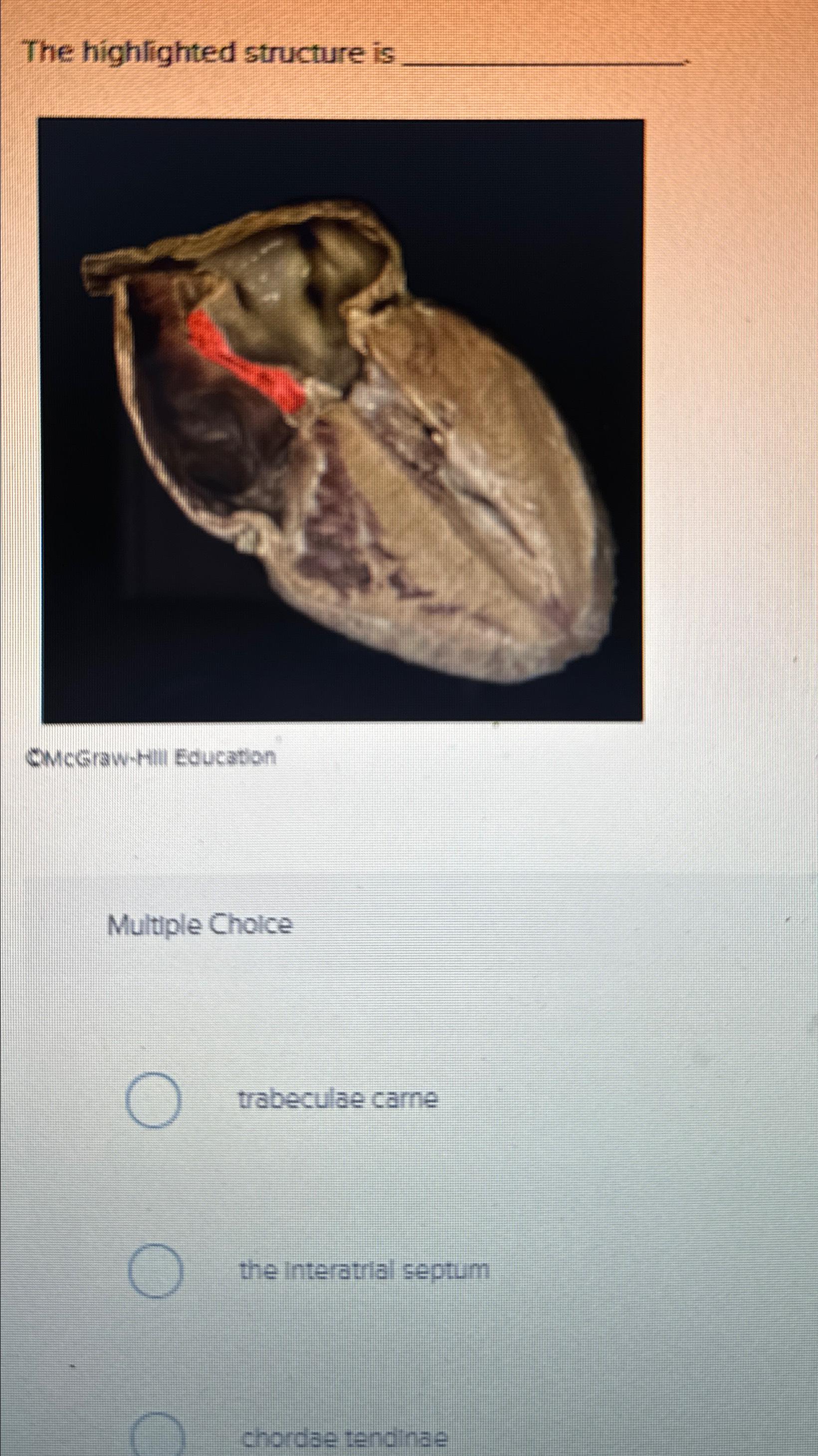 Solved The highlighted structure isOMcGrawtill | Chegg.com