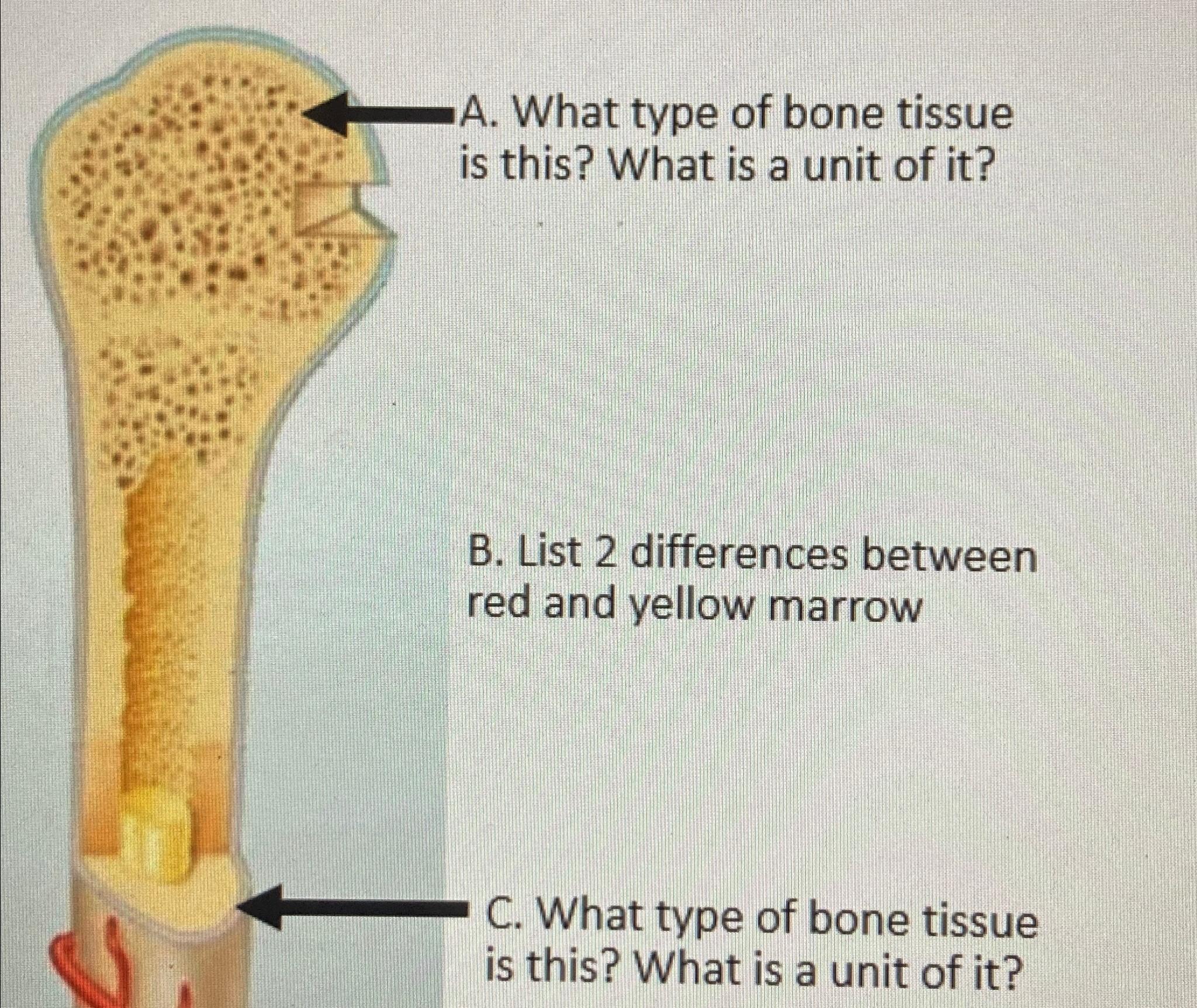 Solved A. ﻿What type of bone tissue is this? What is a unit | Chegg.com