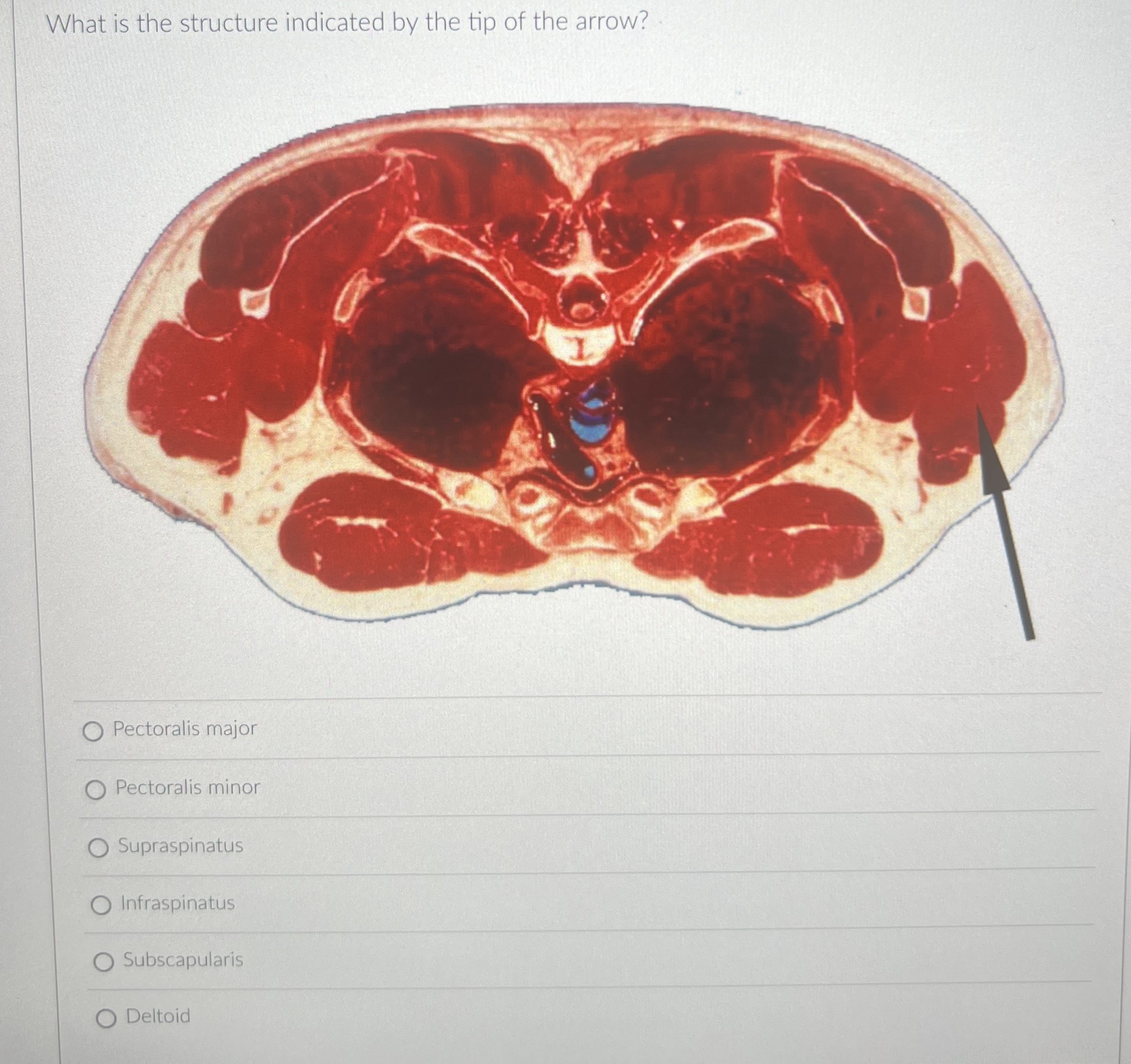 Solved What is the structure indicated by the tip of the | Chegg.com