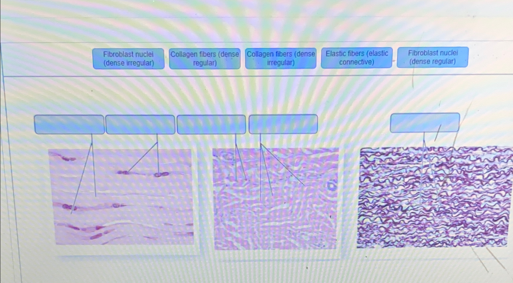 Solved Fibroblast nucleiCollagen fibers (dense (dense | Chegg.com