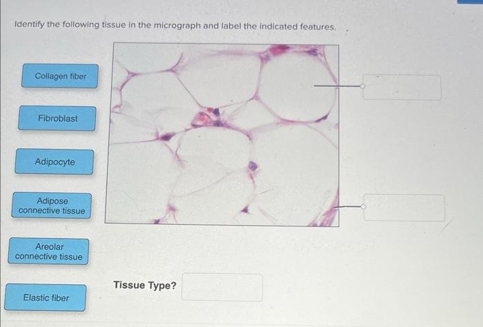Identify the following tissue in the micrograph and | Chegg.com